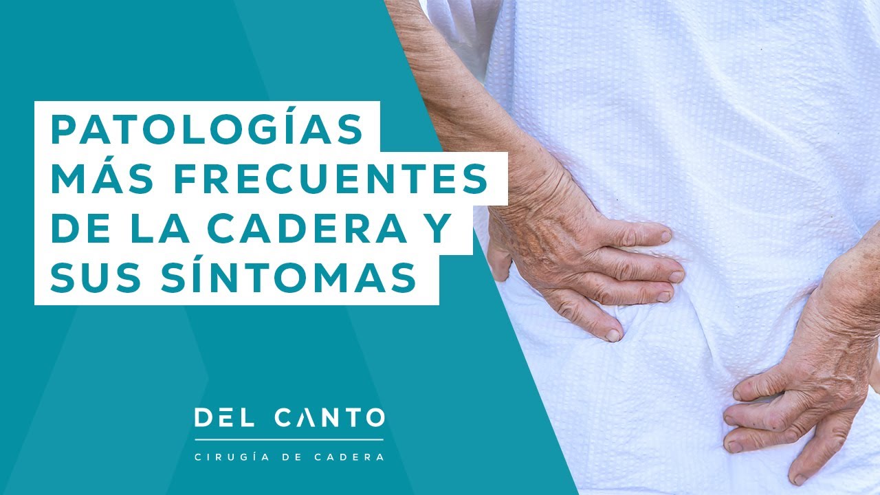 Patologías más frecuentes de la Cadera y sus síntomas | DR. DEL CANTO ...