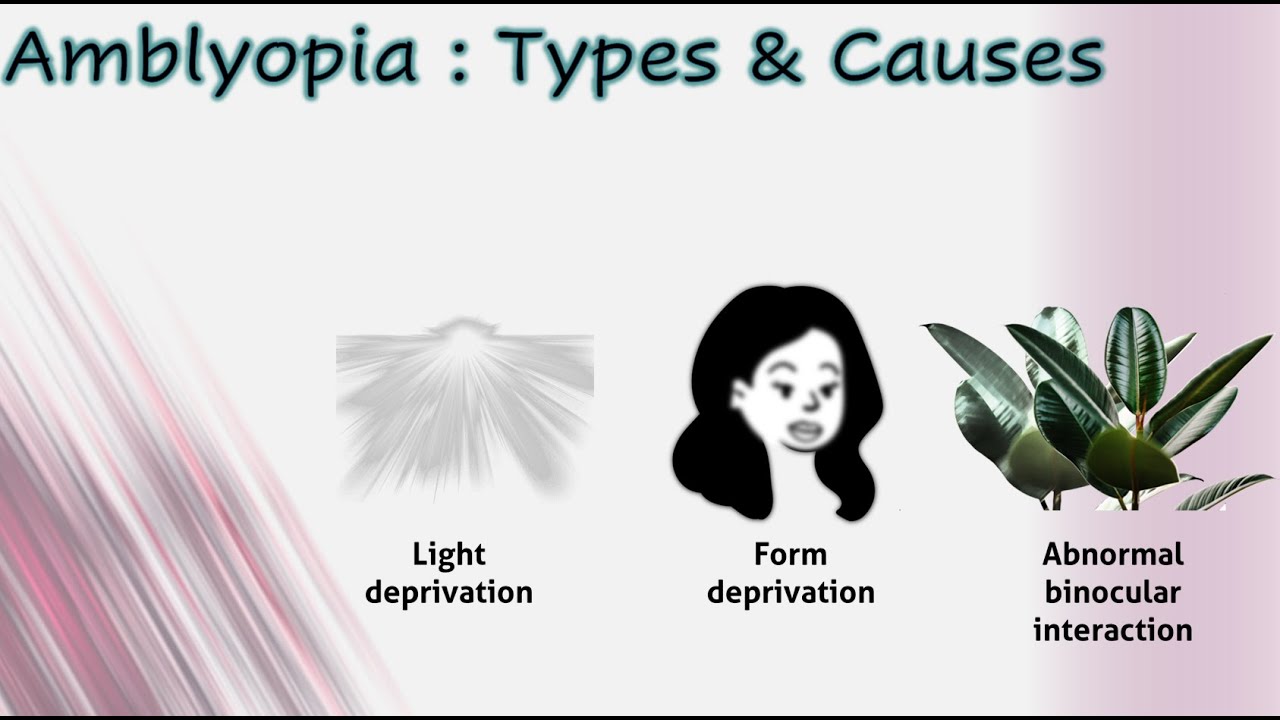 Amblyopia 1│ Types & causes - YouTube