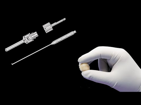 What Is A Bone Graft For Foot Fusion Surgery