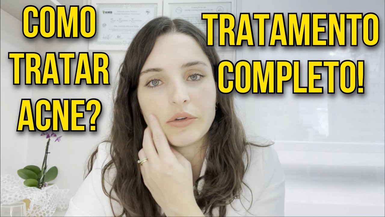 Como tratar ACNE - VÍDEO e TRATAMENTO COMPLETO que REALMENTE FUNCIONAM ...
