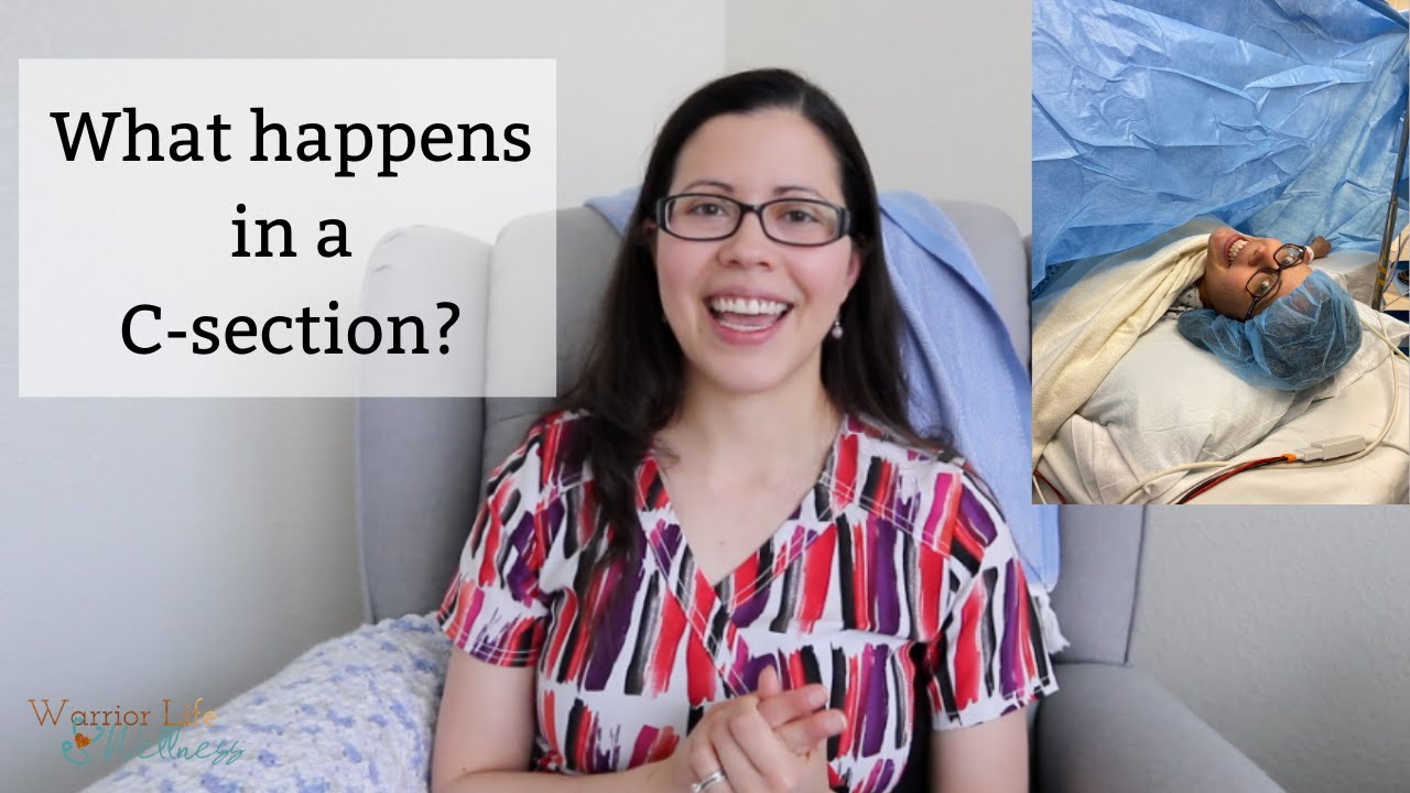 What Happens in a C-Section? | The truth about having a c-section - YouTube