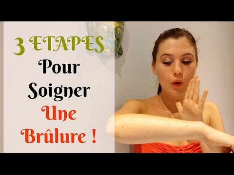 VLOG#17: 3 ÉTAPES pour Soigner une BRÛLURE à SAVOIR ! - YouTube