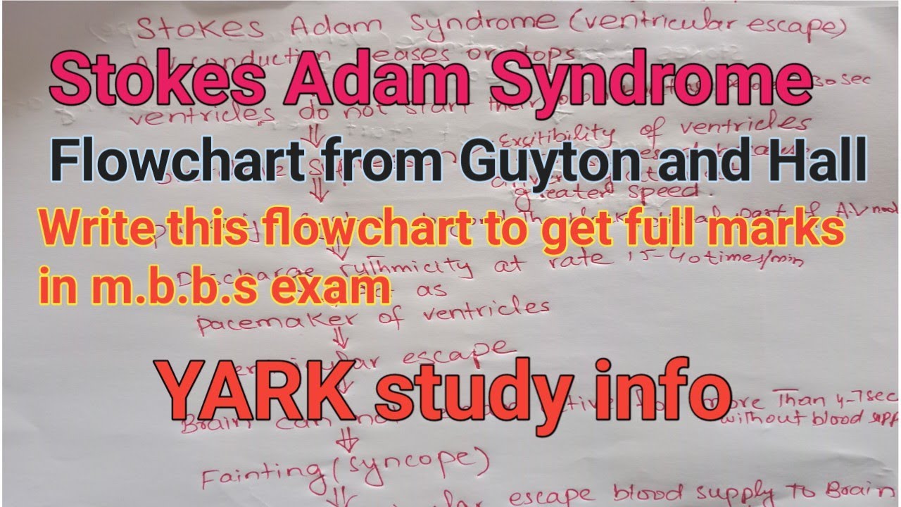 Stokes Adam syndrome flowchart from Guyton chapter 13 Cardiac ...