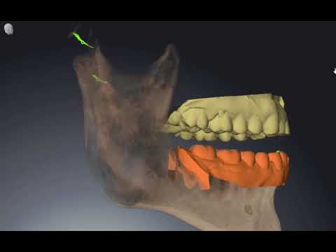 Biofunctional Dynamic Occlusion - YouTube