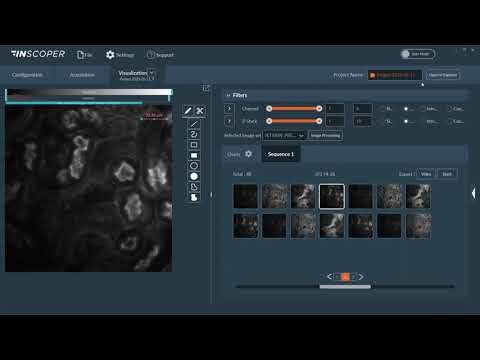 Inscoper I.S. & Jetraw workflow for image acquisition and storage - YouTube