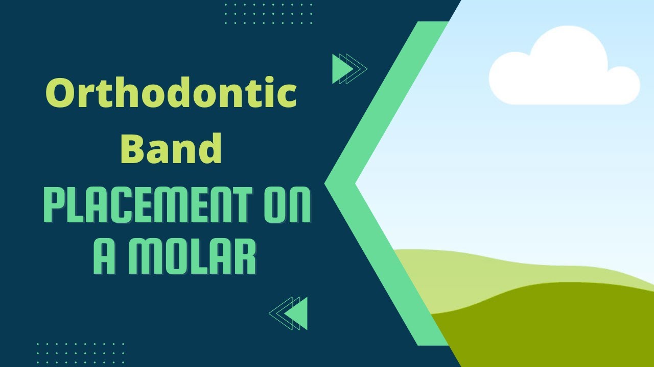 Simple Technique for Placement of Orthodontic Band on a Molar..!! - YouTube
