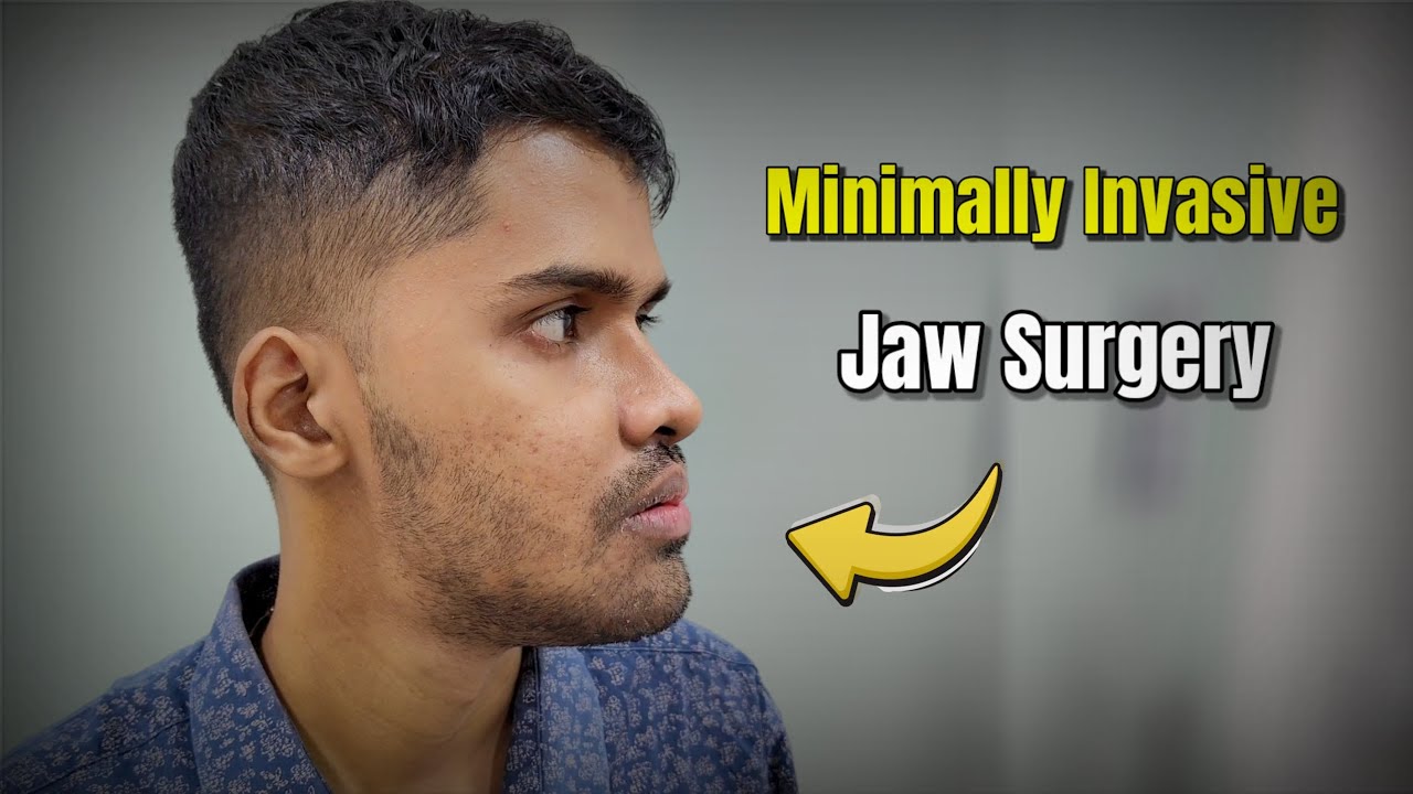 Minimally Invasive Jaw Surgery Recovery 4 Day Post Op Progress With minimally-invasive-jaw-surgery-recovery-4-day-post-op-progress-with