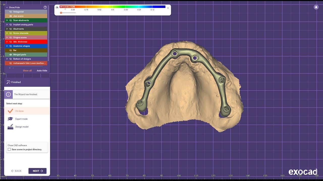 Titanium bar design - upper screw retained basal implant ALL ON 6 in ...