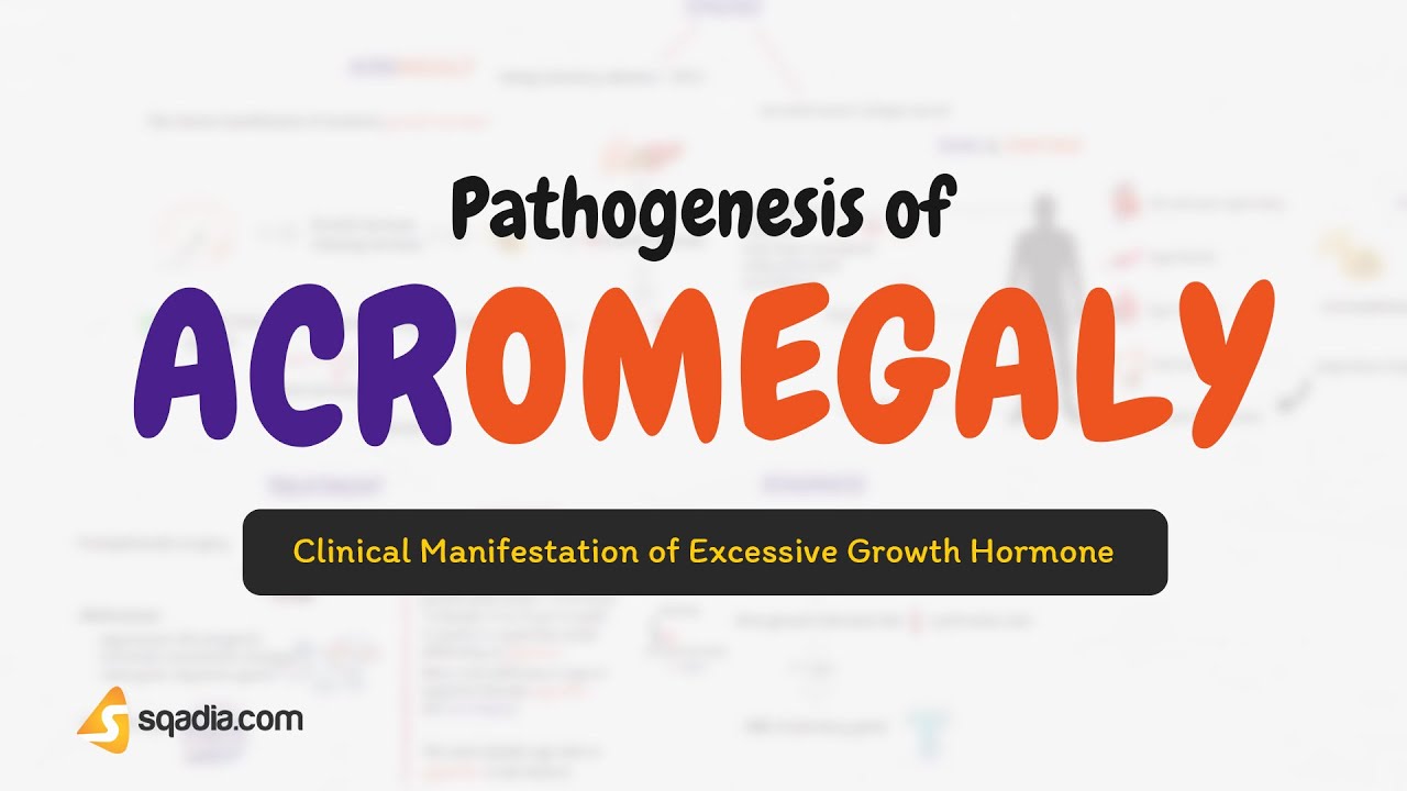 Pathogenesis of Acromegaly | Endocrinology - YouTube