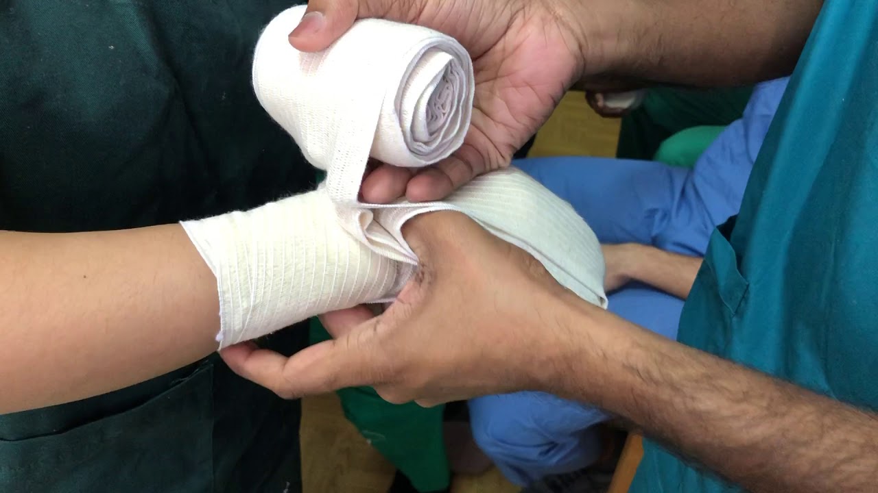 Mitten bandage (Desmurgy) - YouTube