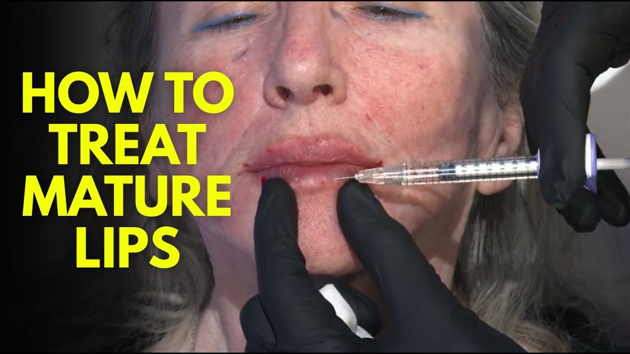 How to Treat Mature Lips Safely and Naturally - YouTube