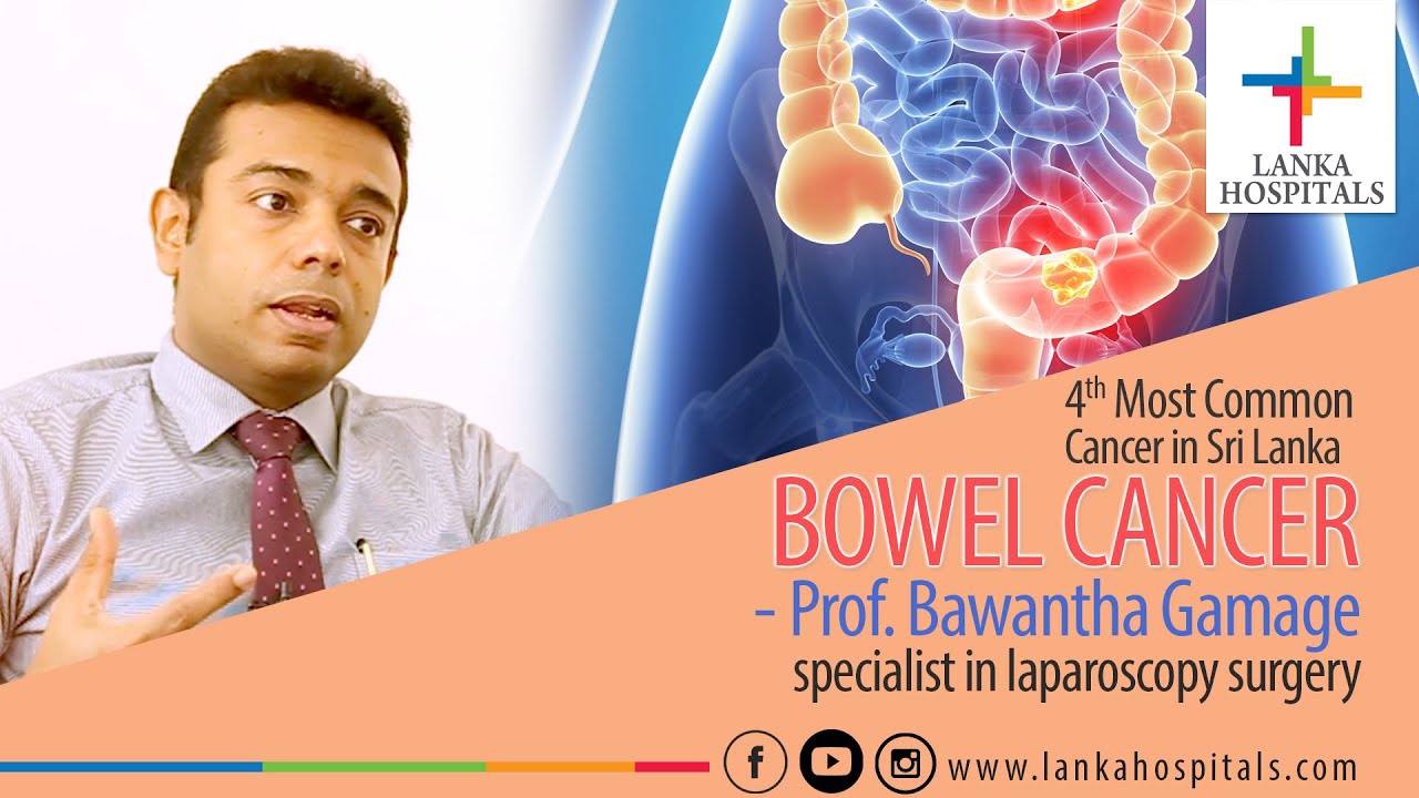 Bowel Cancer - 4th Most Common Cancer in Sri Lanka | Prof. Bawantha Gamage - YouTube