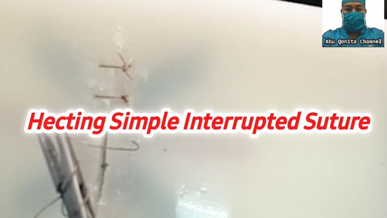 Seri Pembelajaran Perawat : # 31 Hecting Simple Interrupted Suture - YouTube