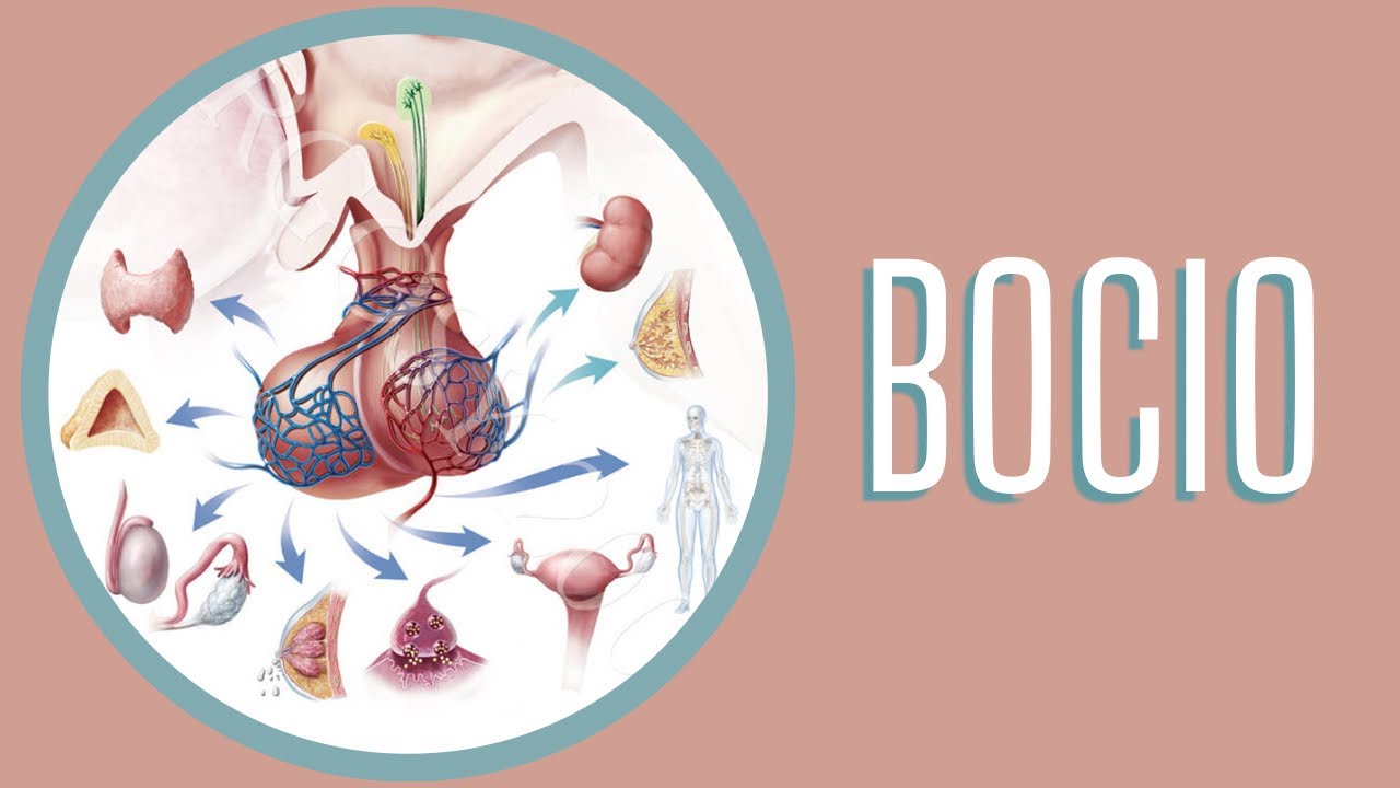 Endocrinología - Bocio - YouTube