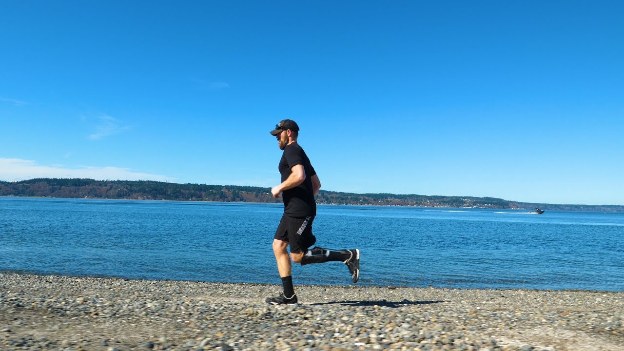 UK Patient flies in to get Dynamic Brace from Cornerstone Prosthetics - YouTube