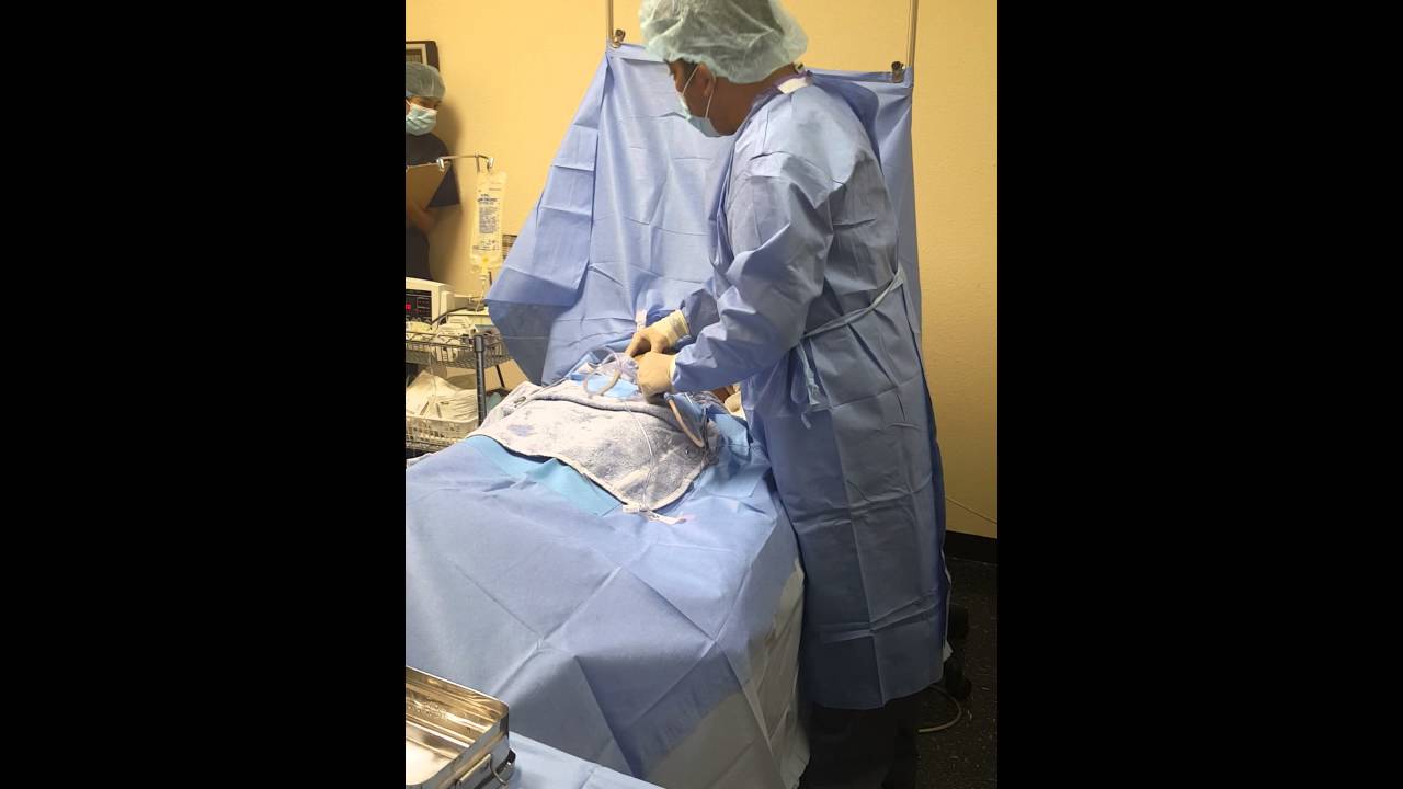 Dr. Novoa- Danielle Awake Liposuction(2) - YouTube