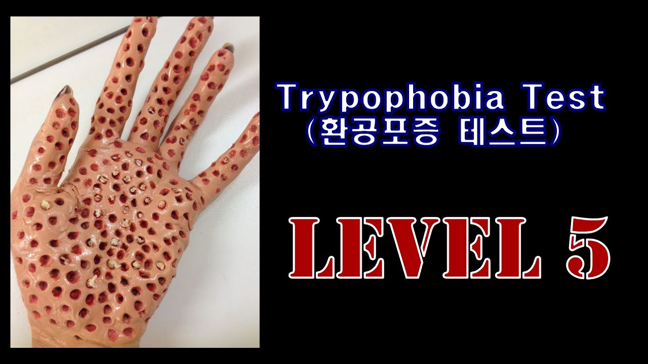 TRYPOPHOBIA TEST (환 공포증 테스트) 등급별로 테스트 진행 Level 1~5 - YouTube