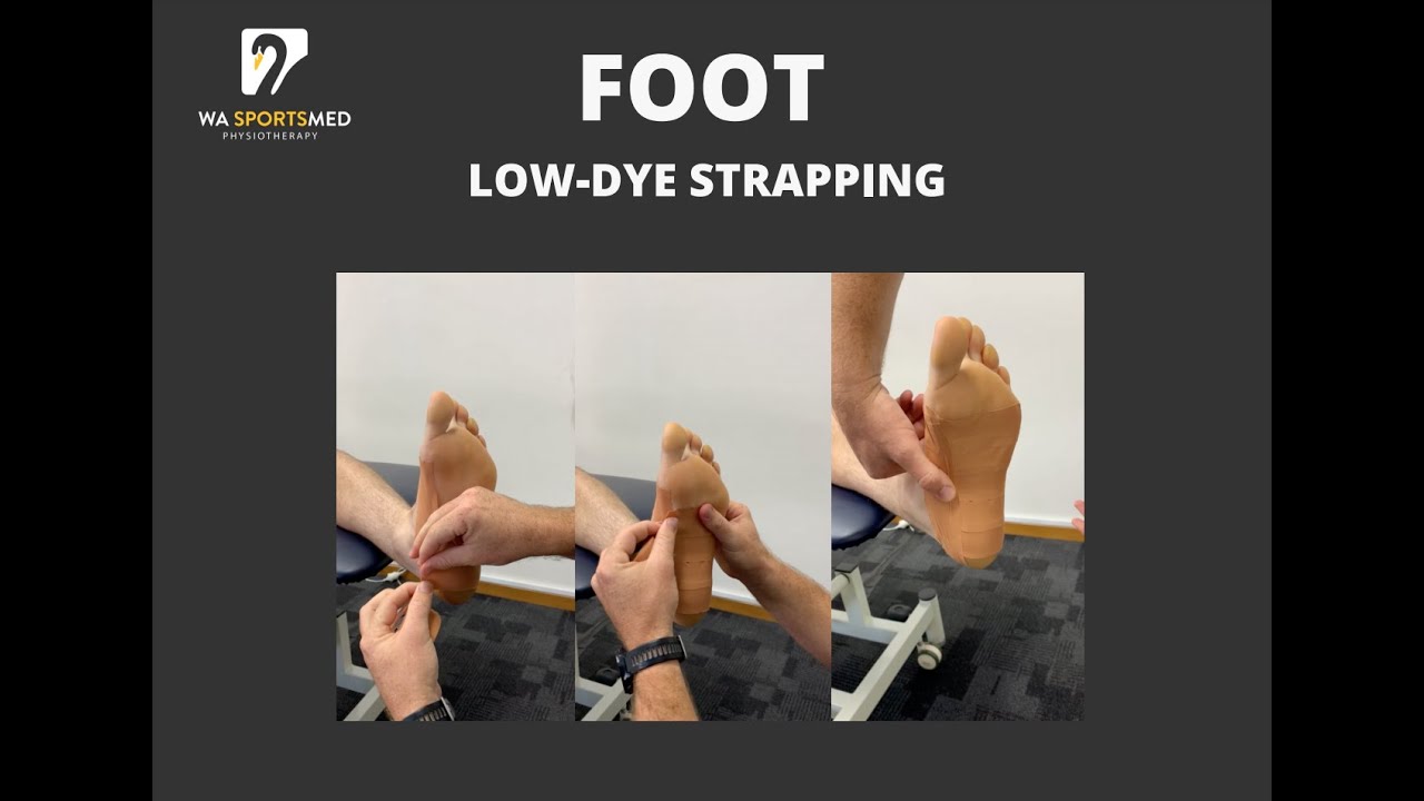 Taping series- Low-Dye foot strapping. - YouTube