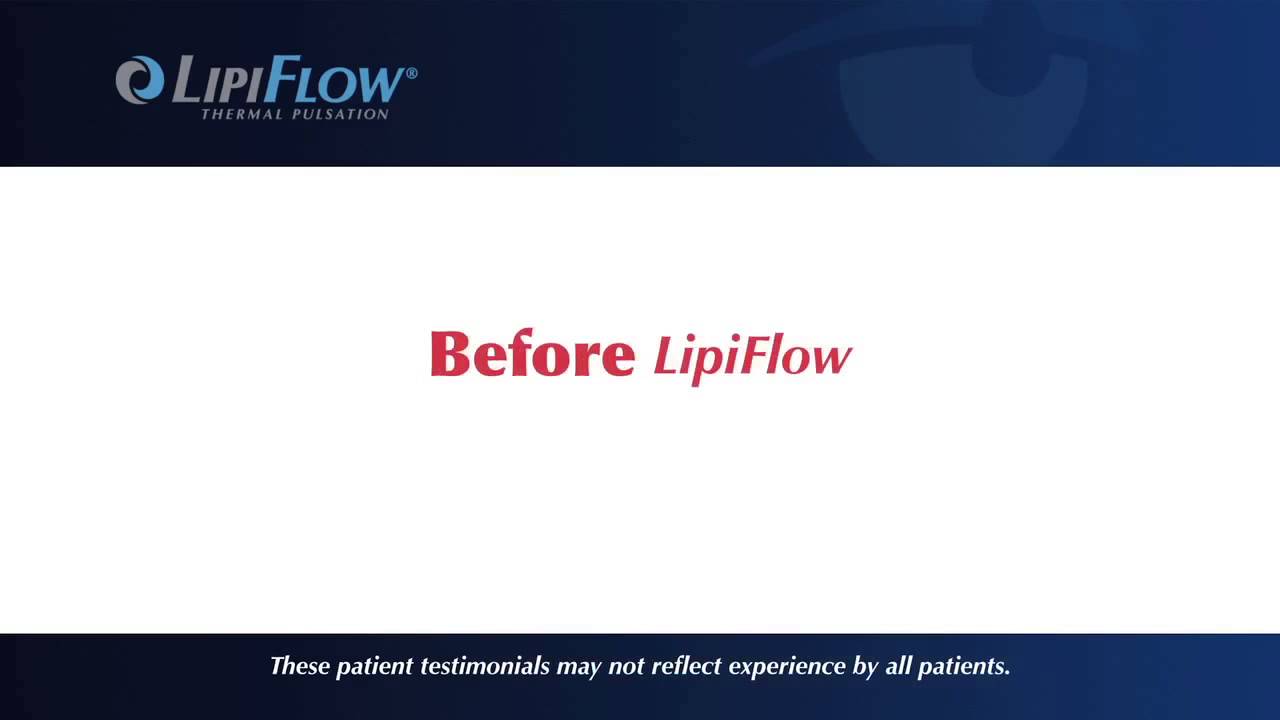 LipiFlow Patient Video1 - YouTube
