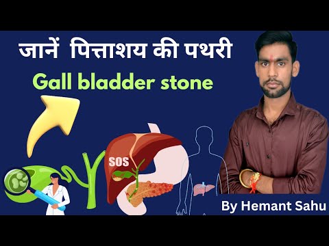 Jane gall bladder stone kya hai||Gall bladder stone||#hs_daily_carrent ...
