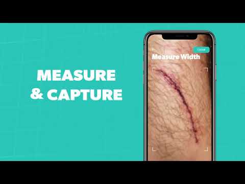 Wound Capture - Digital Wound Documentation - AR Kit, Core ML, ML Kit ...