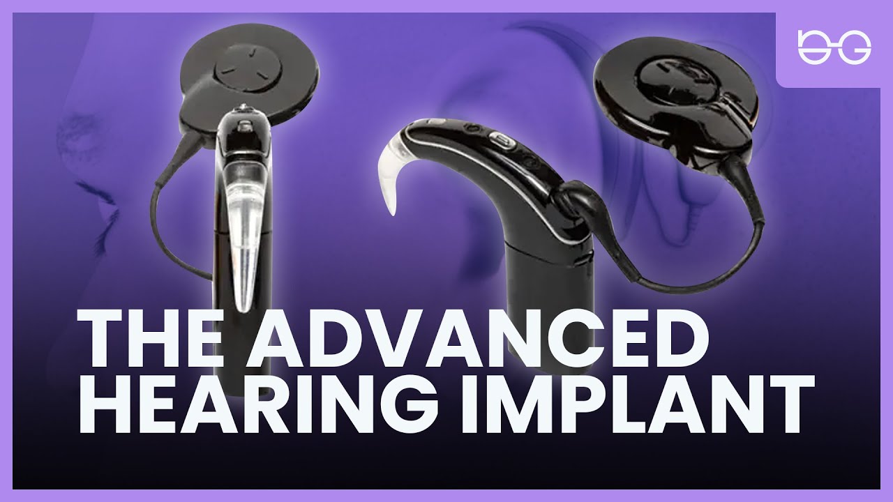Bionic Ears: Hearing Implant - YouTube