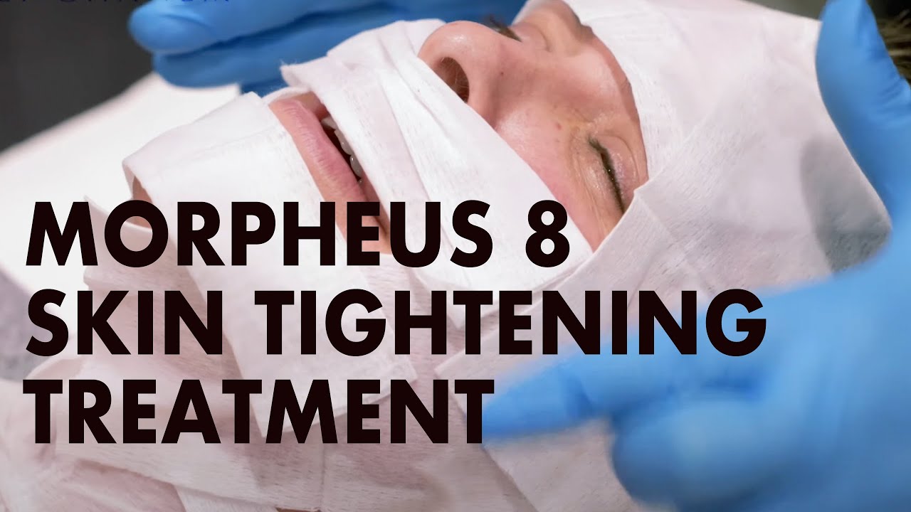 Morpheus8 | Skin Tightening Demonstration with Dr. Ali Ghanem #morpheus8 - YouTube
