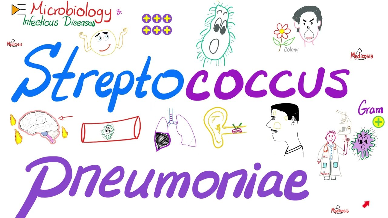 Lancet Shaped Streptococcus Pneumoniae