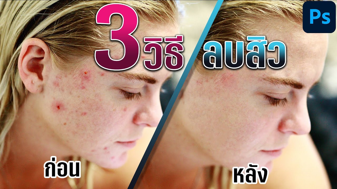3 วิธีลบสิว ลบริ้วรอย ด้วยโปรแกรม | Photoshop #อยากเก่งกราฟิกต้องเริ่ม ...
