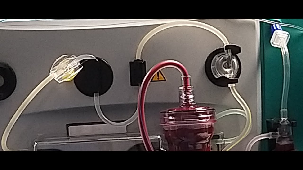 Montaje Monitor Prismaflex - YouTube