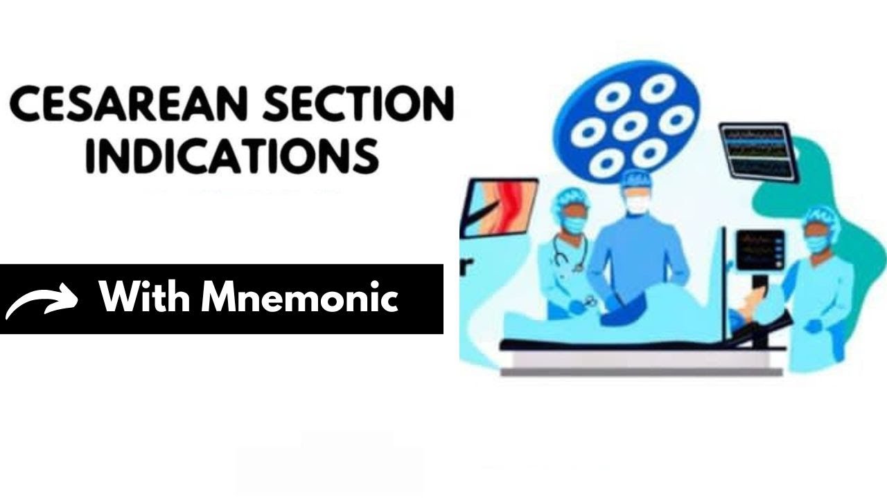 Cesarean Section Indications With Mnemonic | Obstetrics Mnemonics | Dr ...