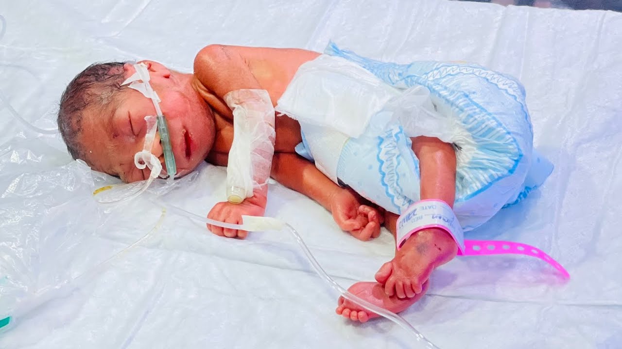 7-Months Premature Baby | Low Birth Weight | Oxygen Dependent | NICU ...