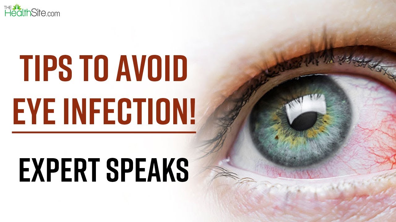 Eye Infection: Know How To Get Rid Of Eye Infections Easily, Expert ...