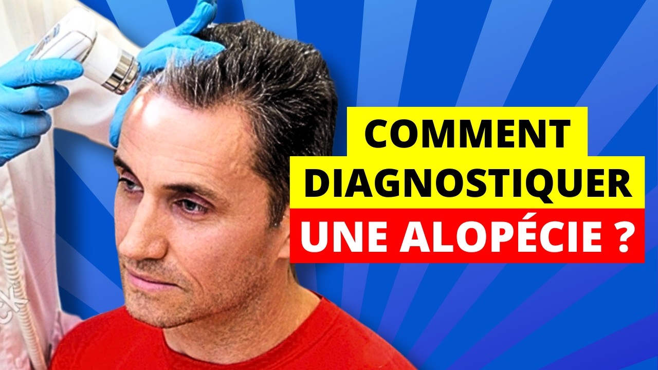 Mes 4 conseils Incontournables pour déceler une Calvitie… à temps ...