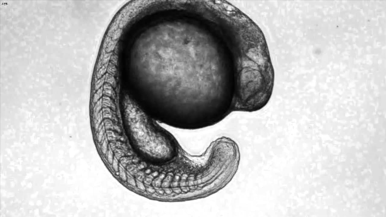 Zebrafish somitogenesis - YouTube