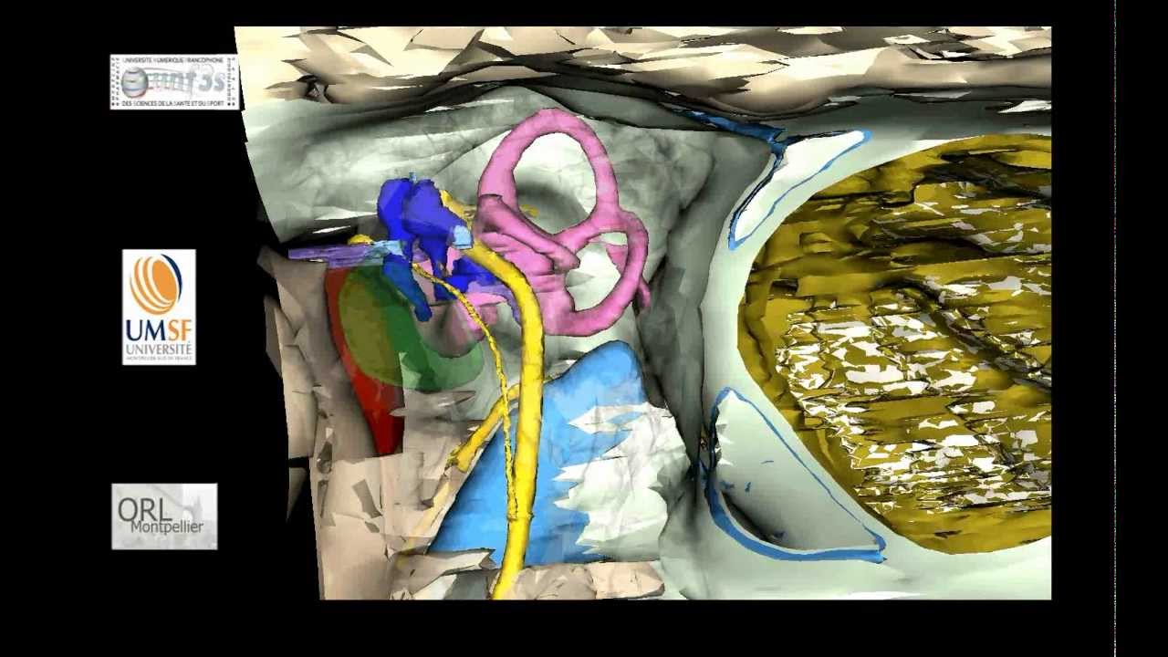 anatomie 3D de l'os temporal - vue d'ensemble - YouTube