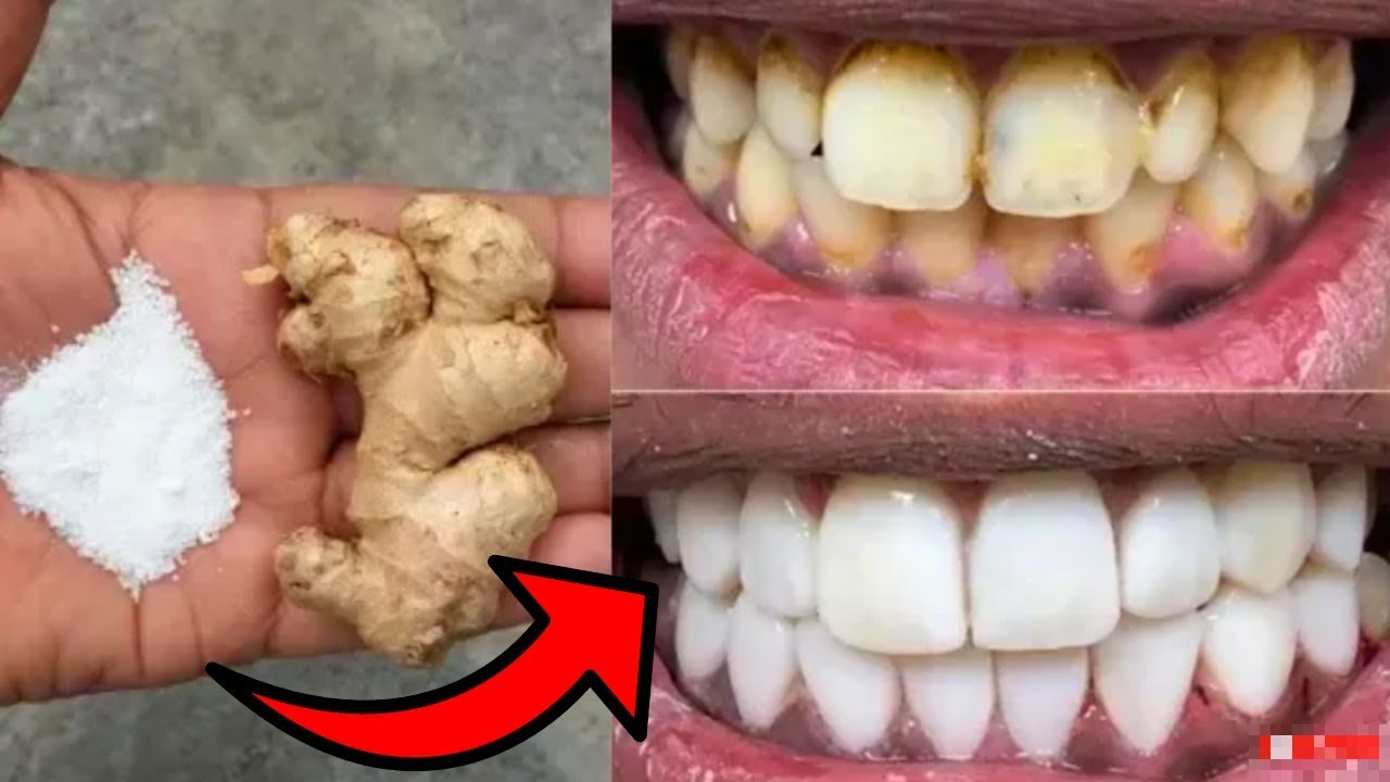 Just 2 Minutes Teeth Natural clean Tips || Lemon - YouTube