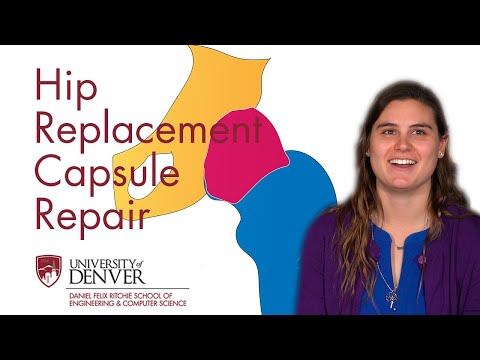 Hip Replacement Methods: Capsule Repair Research at Ritchie School of Engineering & Computer Science