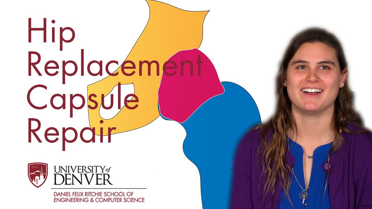 Hip Replacement Capsule Repair Research - YouTube