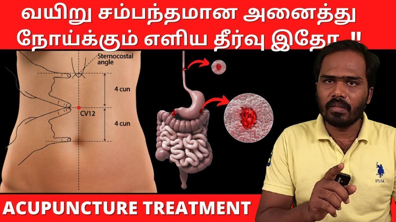 ALL STOMACH RELATED DISEASES !! STOMACH FRONT MU & BACK SHU POINTS ...