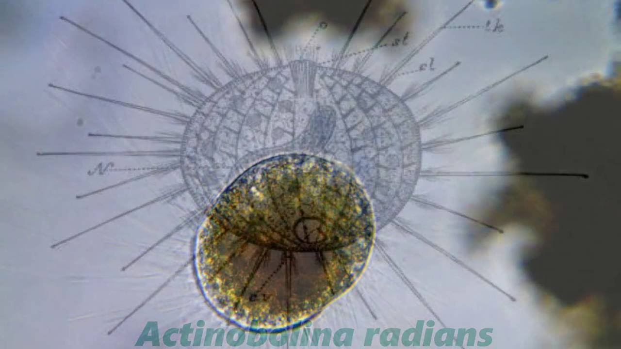 Actinobolina radians -- a ciliate that looks like a heliozoan - YouTube
