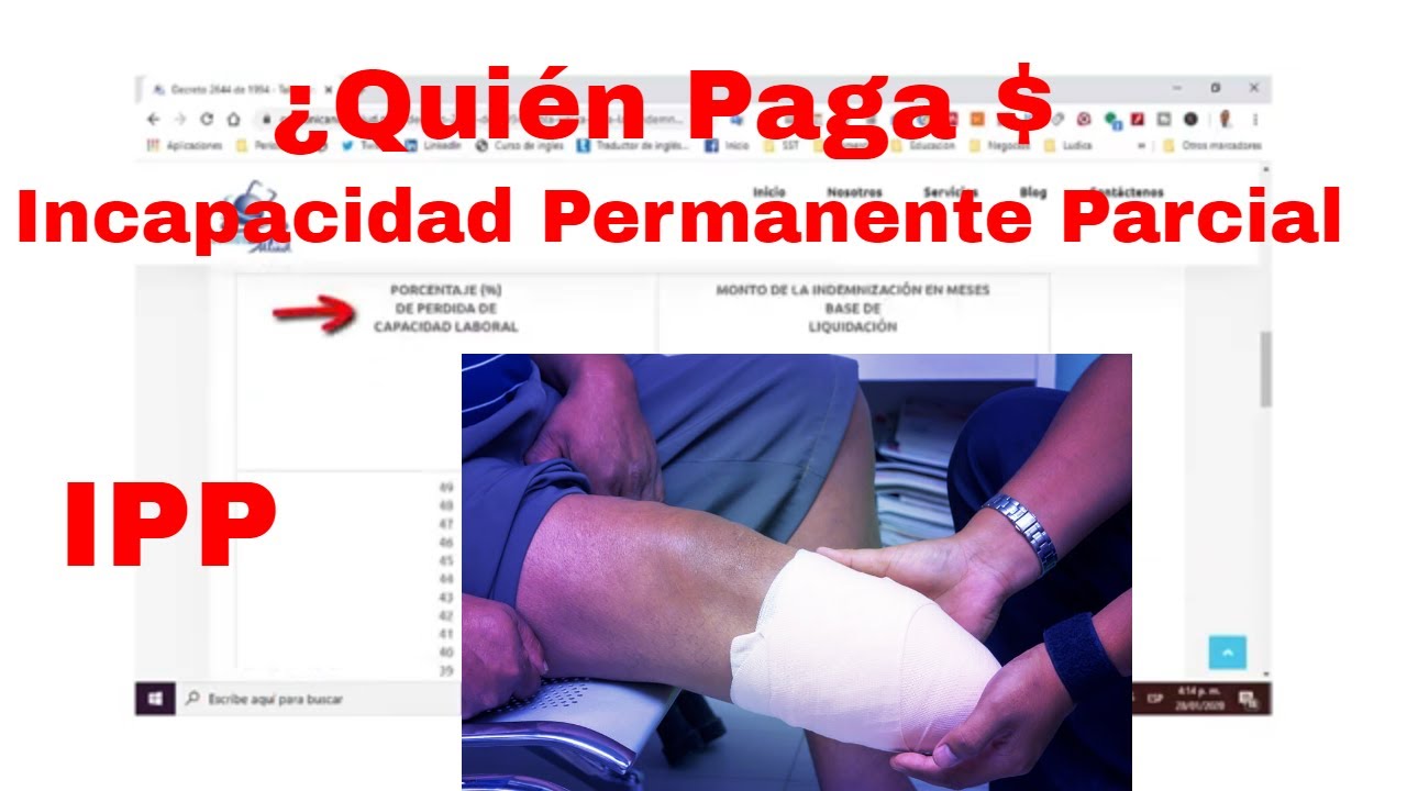 🔴 ¿Cómo se Realiza la Indemnización por Incapacidad Permanente Parcial ...