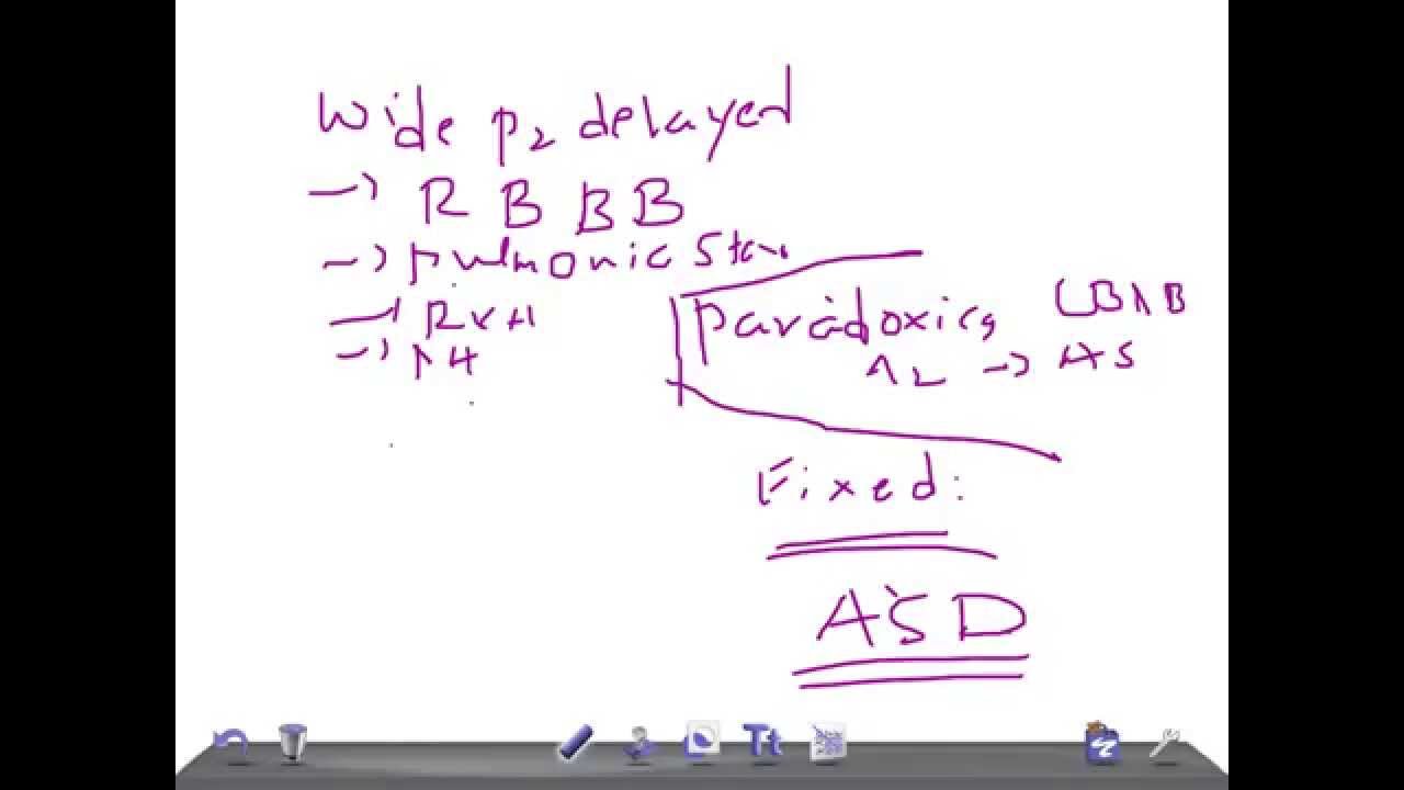 QUICK INTERNAL MEDICINE: Causes for Splitting of second heart sound S2 ...
