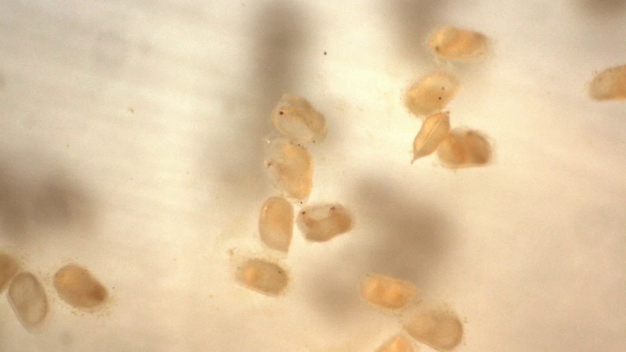 Hatching of Moina resting eggs - YouTube