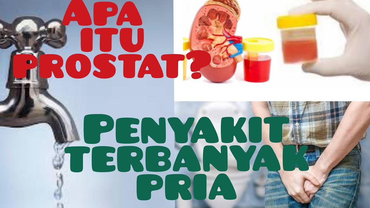 Apa itu Prostat: Susah Kencing, Ngeden, Kencing Tidak Lampias, BAK ...