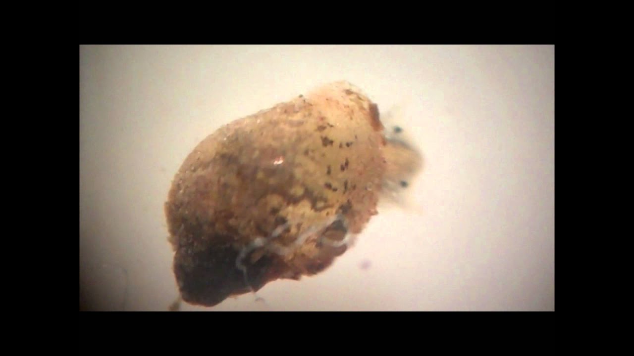 Snail under Microscope - YouTube