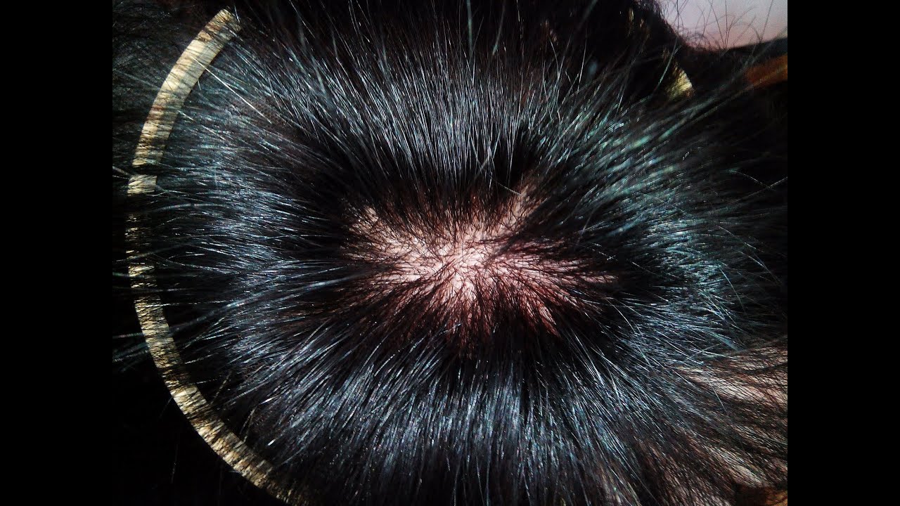 Closures with rounded back - YouTube