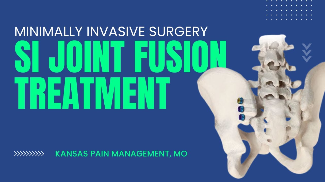 Minimally Invasive Surgery SI Joint Fusion Treatment for Back Pain ...