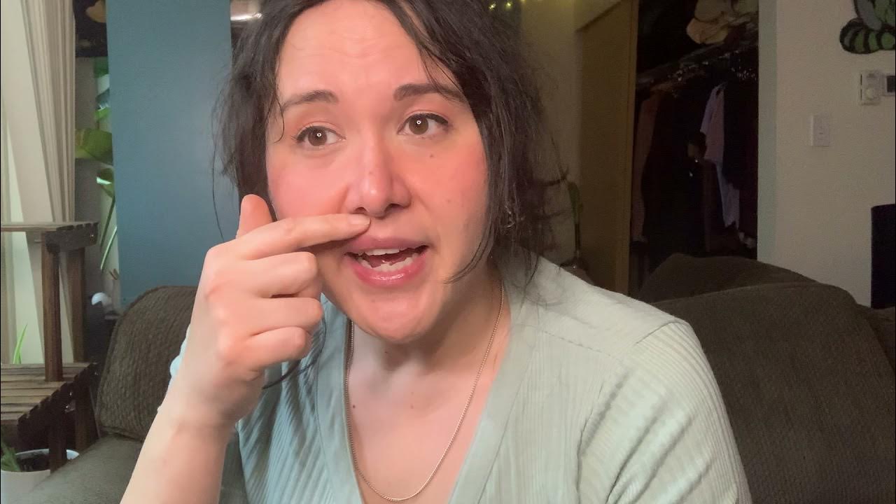 One year post-FFS with Dr. Mardirossian - Jan 12 2022 - YouTube