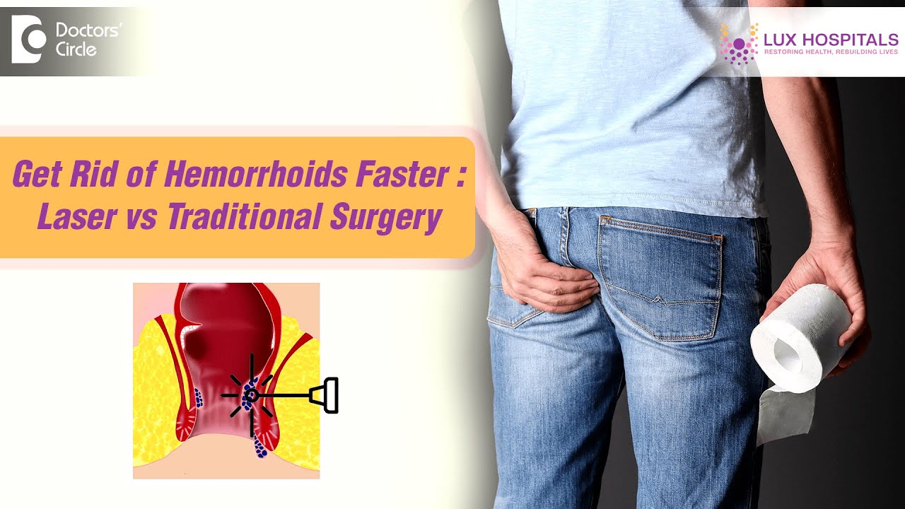 Piles| Get rid of PILES Fast| Laser vs Traditional Hemorrhoidectomy # ...